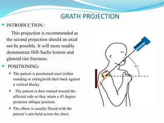 Radiograpic views for shoulder joint | PPTX