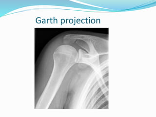 Radiograpic views for shoulder joint | PPTX