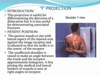 Radiograpic views for shoulder joint | PPTX