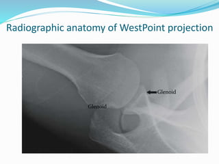 Radiograpic views for shoulder joint | PPTX