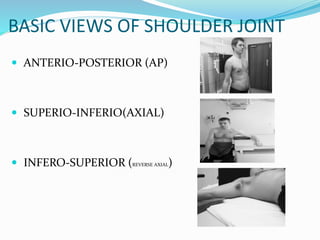 Radiograpic views for shoulder joint | PPTX
