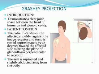 Radiograpic views for shoulder joint | PPTX