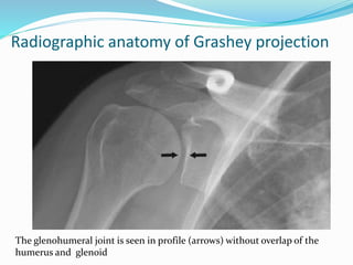Radiograpic views for shoulder joint | PPTX