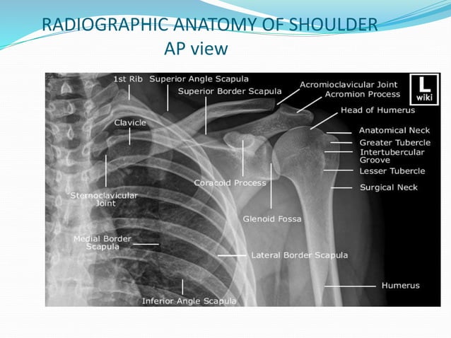 Radiograpic views for shoulder joint | PPTX | Death, Injury, or ...