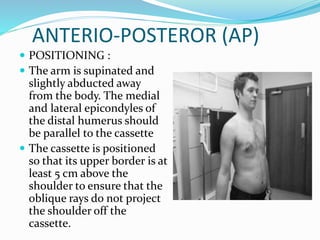 Radiograpic views for shoulder joint | PPT