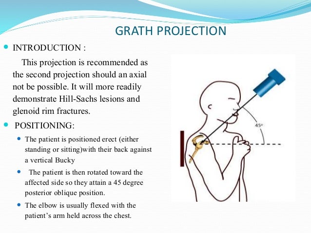 Radiograpic views for shoulder joint