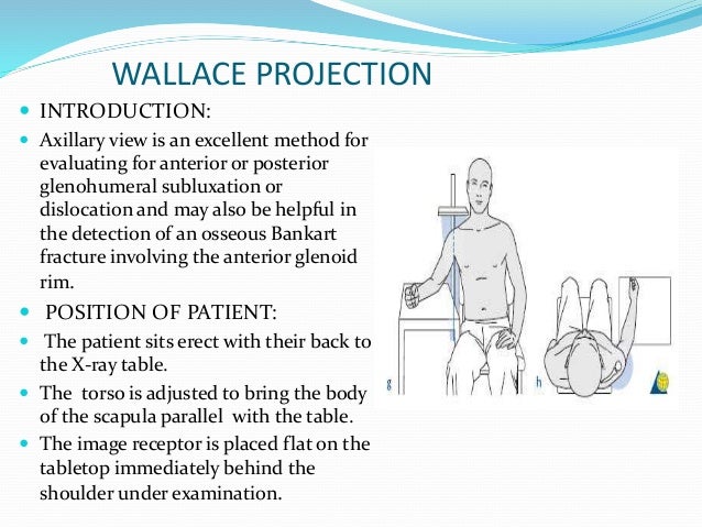 Radiograpic views for shoulder joint