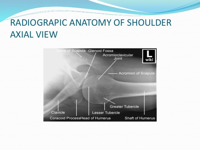Radiograpic views for shoulder joint