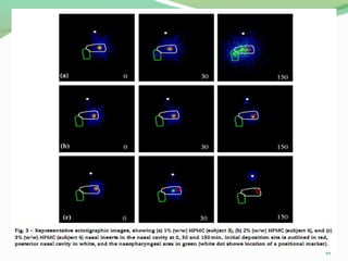Radio Imaging Techniques | PPT