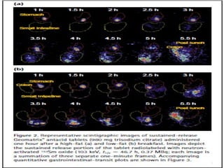 Radio Imaging Techniques | PPT