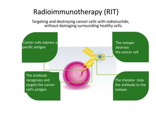 RADIOIMMUNOTHERAPY.pptx