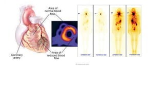 Radioisotope | PPTX