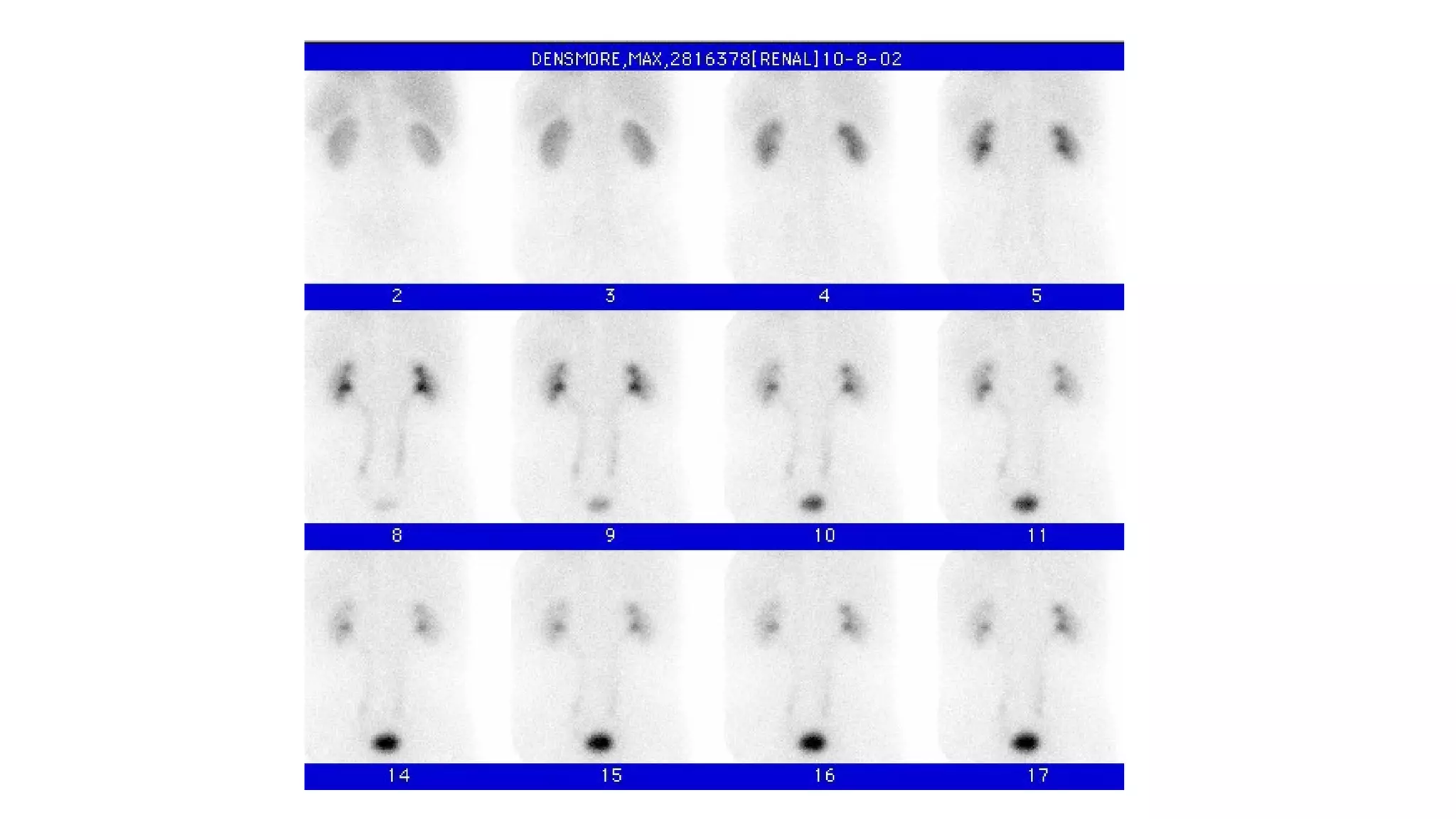 Radioisotope imaging | PPT