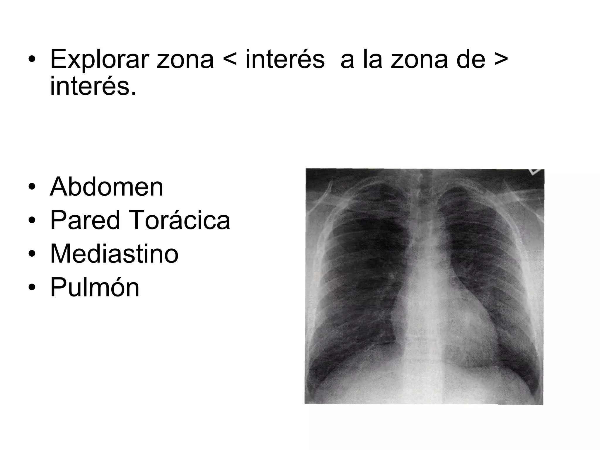 RadiologíA De TóRax Normal | PPT | Lung and Respiratory Health ...