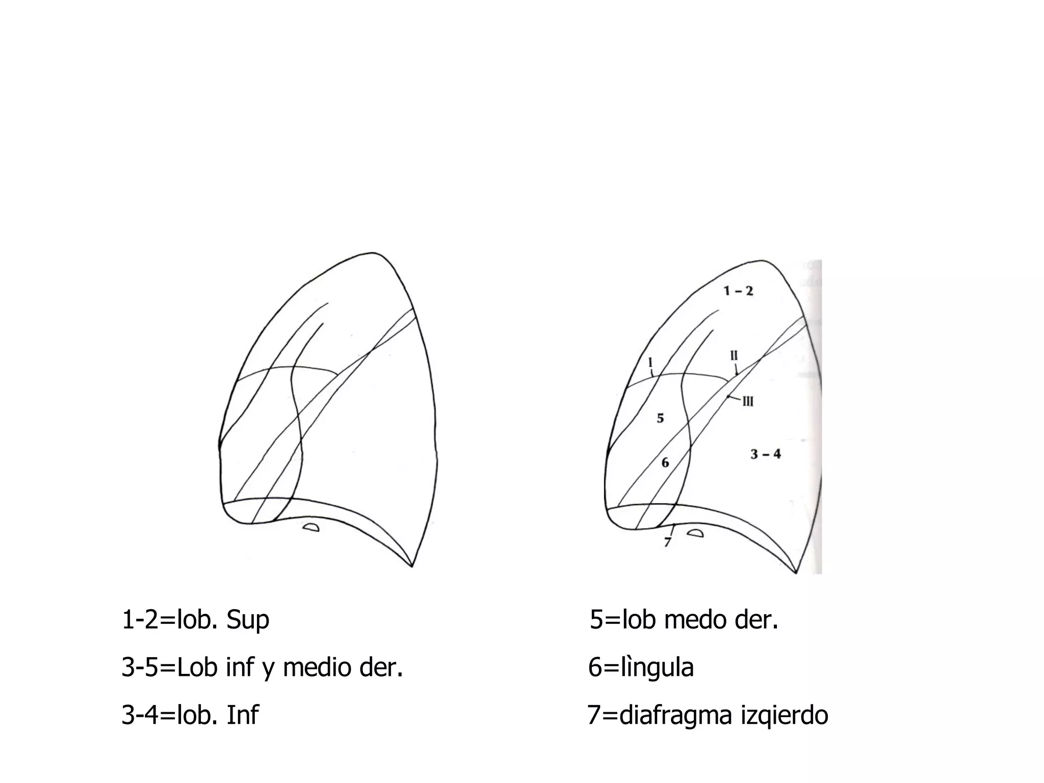 RadiologíA De TóRax Normal | PPT | Lung and Respiratory Health ...
