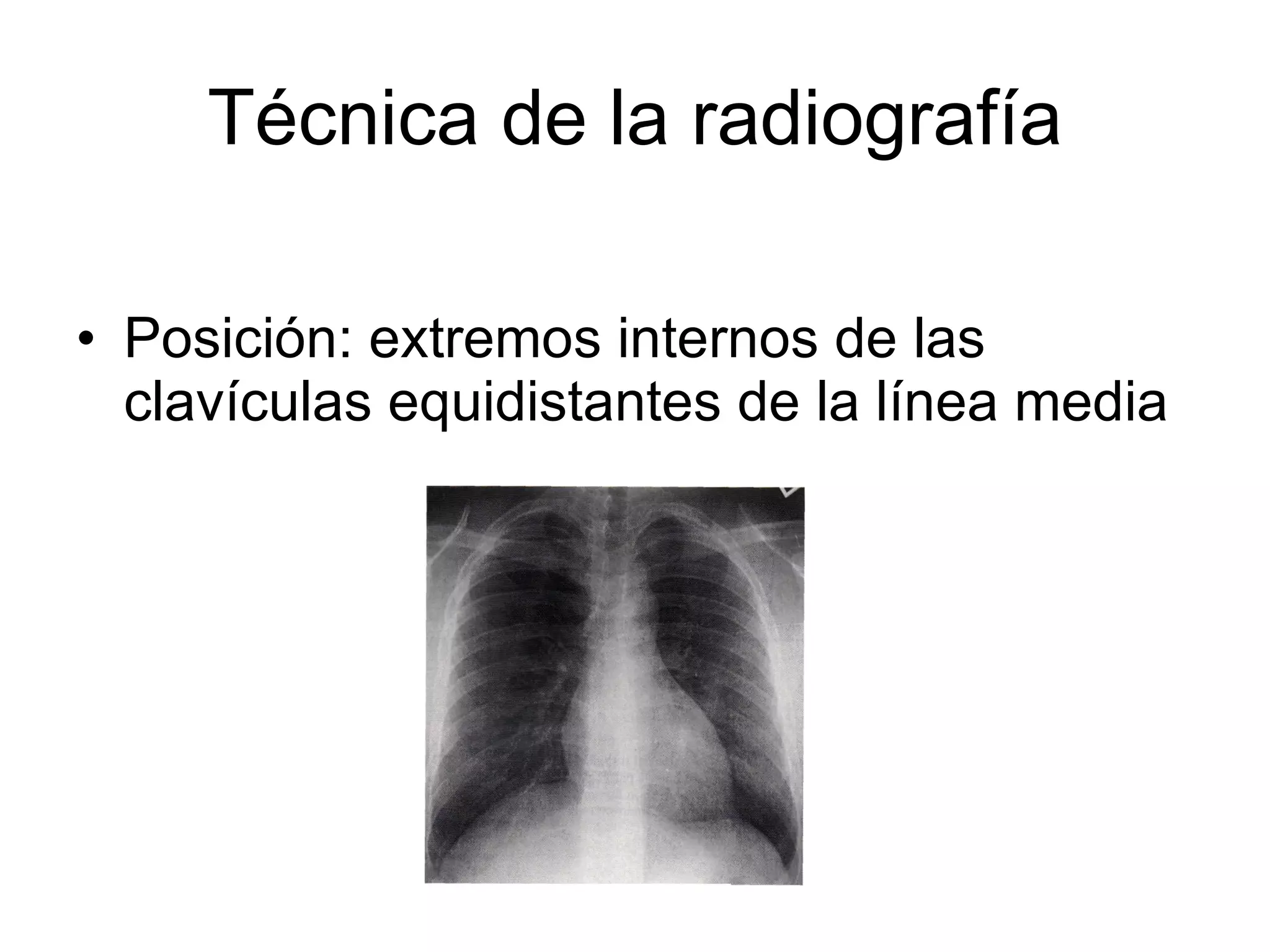 RadiologíA De TóRax Normal | PPT | Lung and Respiratory Health ...