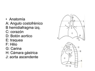 RadiologíA De TóRax Normal | PPT