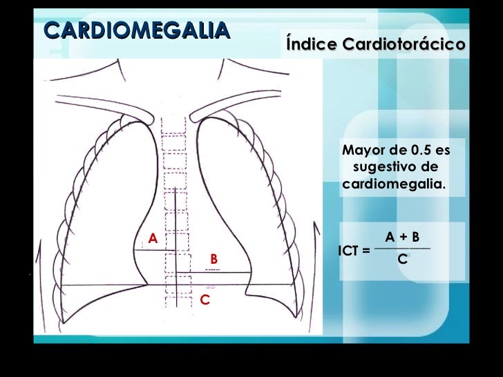 Radiología de corazón