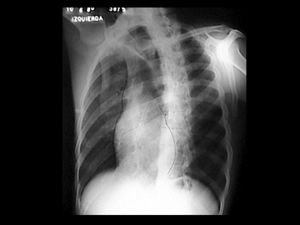 Radiología de corazón