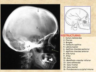 Radiología de cráneo normal.pdf_neuroanatomía | PDF