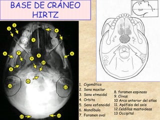 Radiología de cráneo normal.pdf_neuroanatomía | PDF