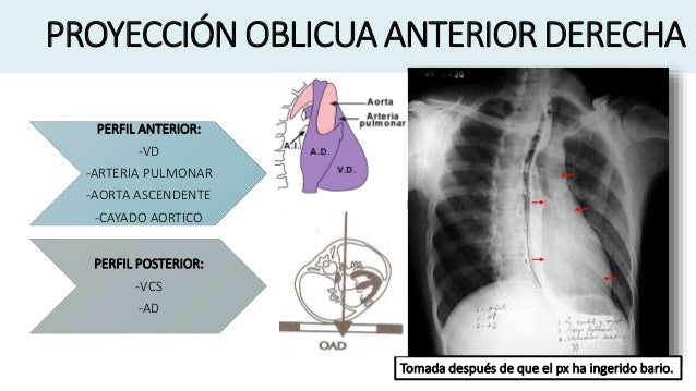 Radiología del corazón