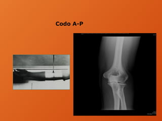 Radiología del miembro superior e inferior resumen práctico.pptx