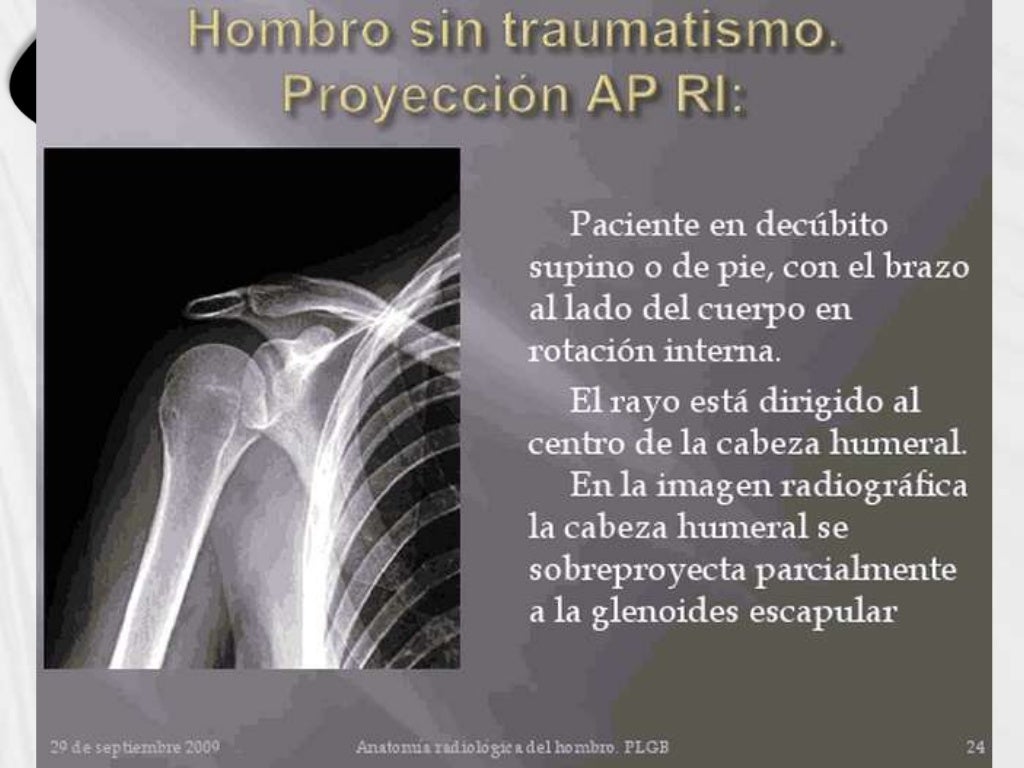 Radiología hombro
