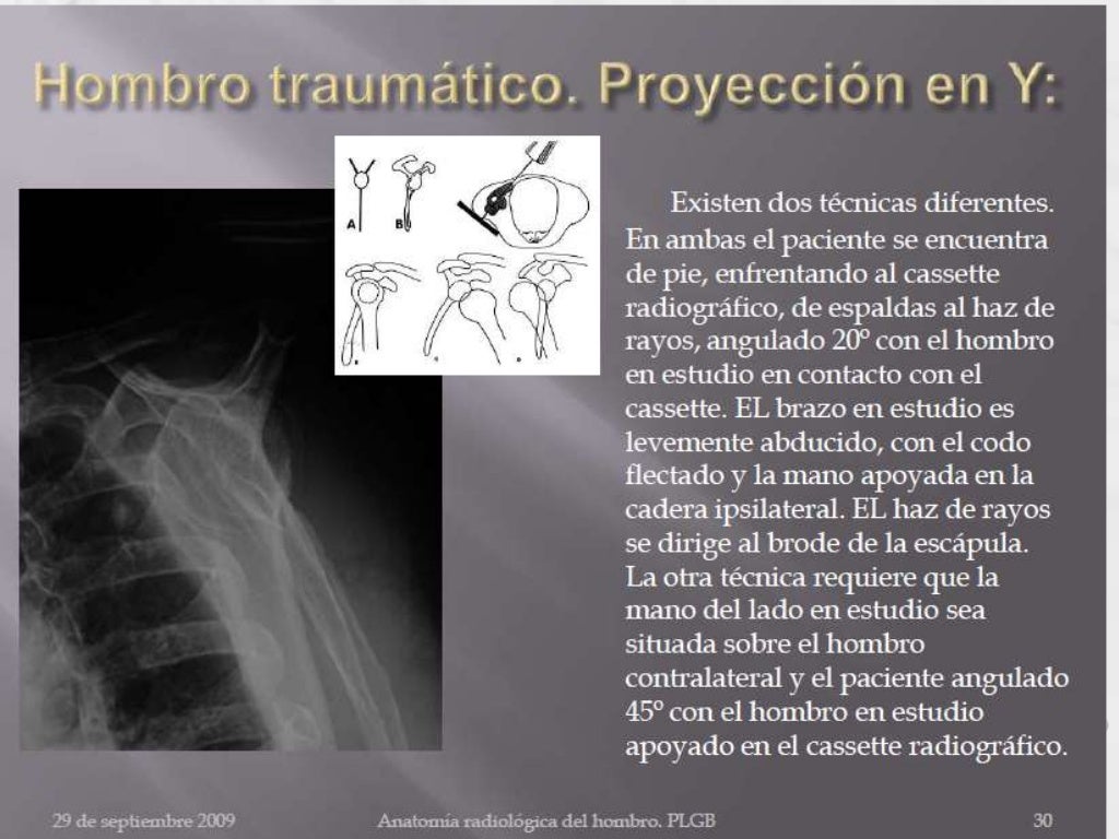 Radiología hombro