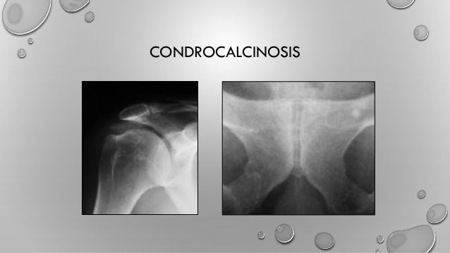Radiología osteoarticular no traumática.