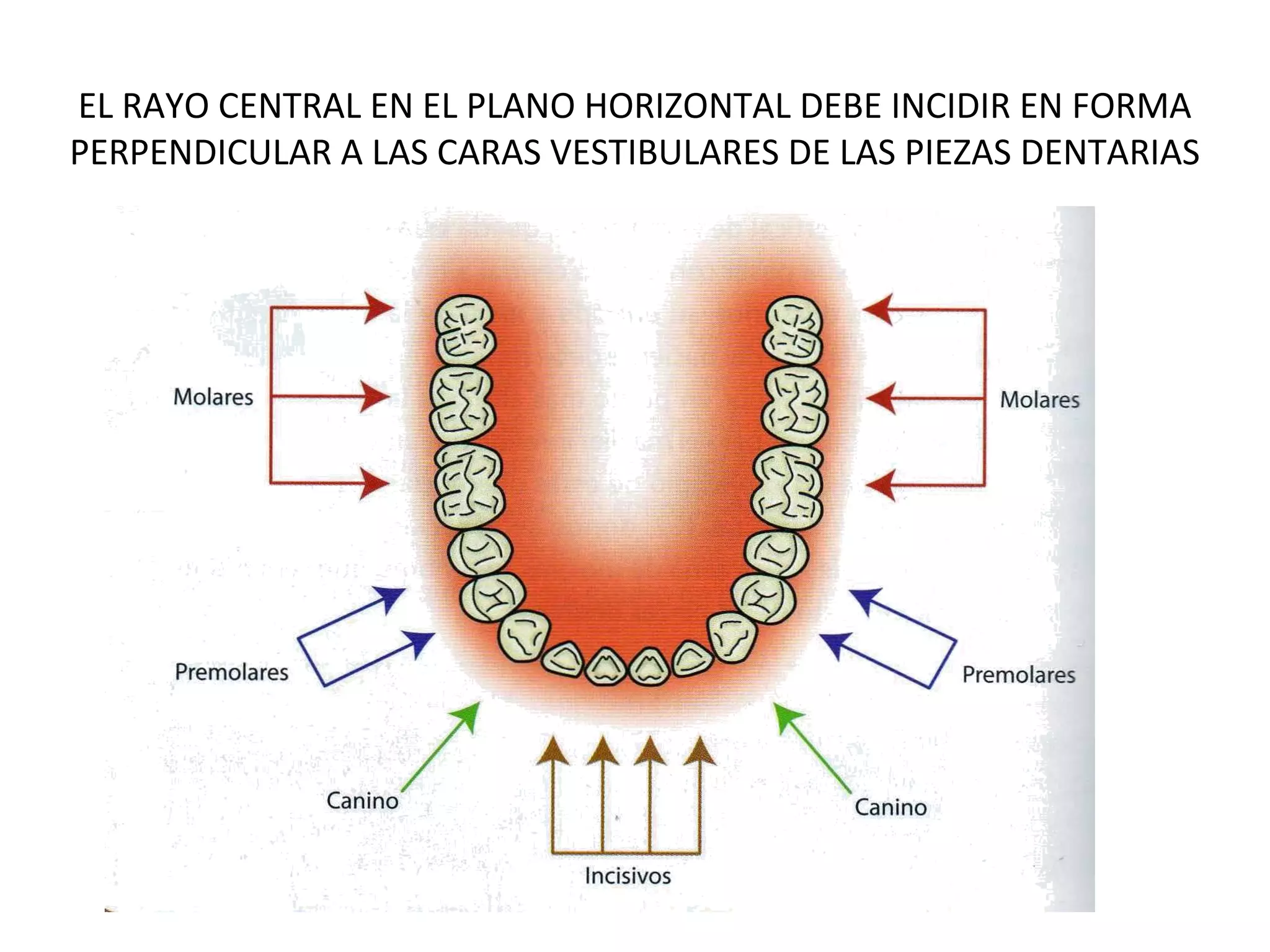 Tecnica de la bisectriz | PPT