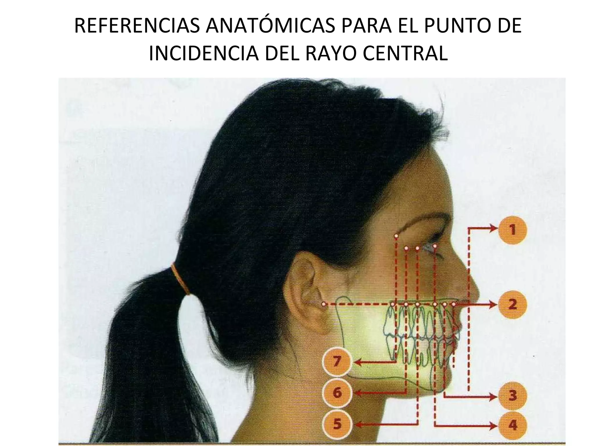 Tecnica de la bisectriz | PPT