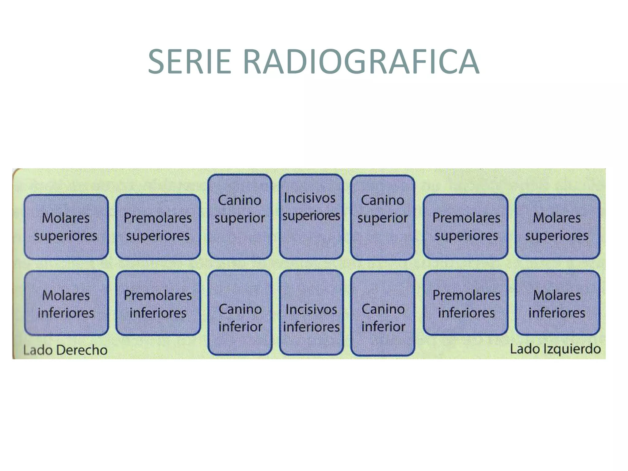 Tecnica de la bisectriz | PPT