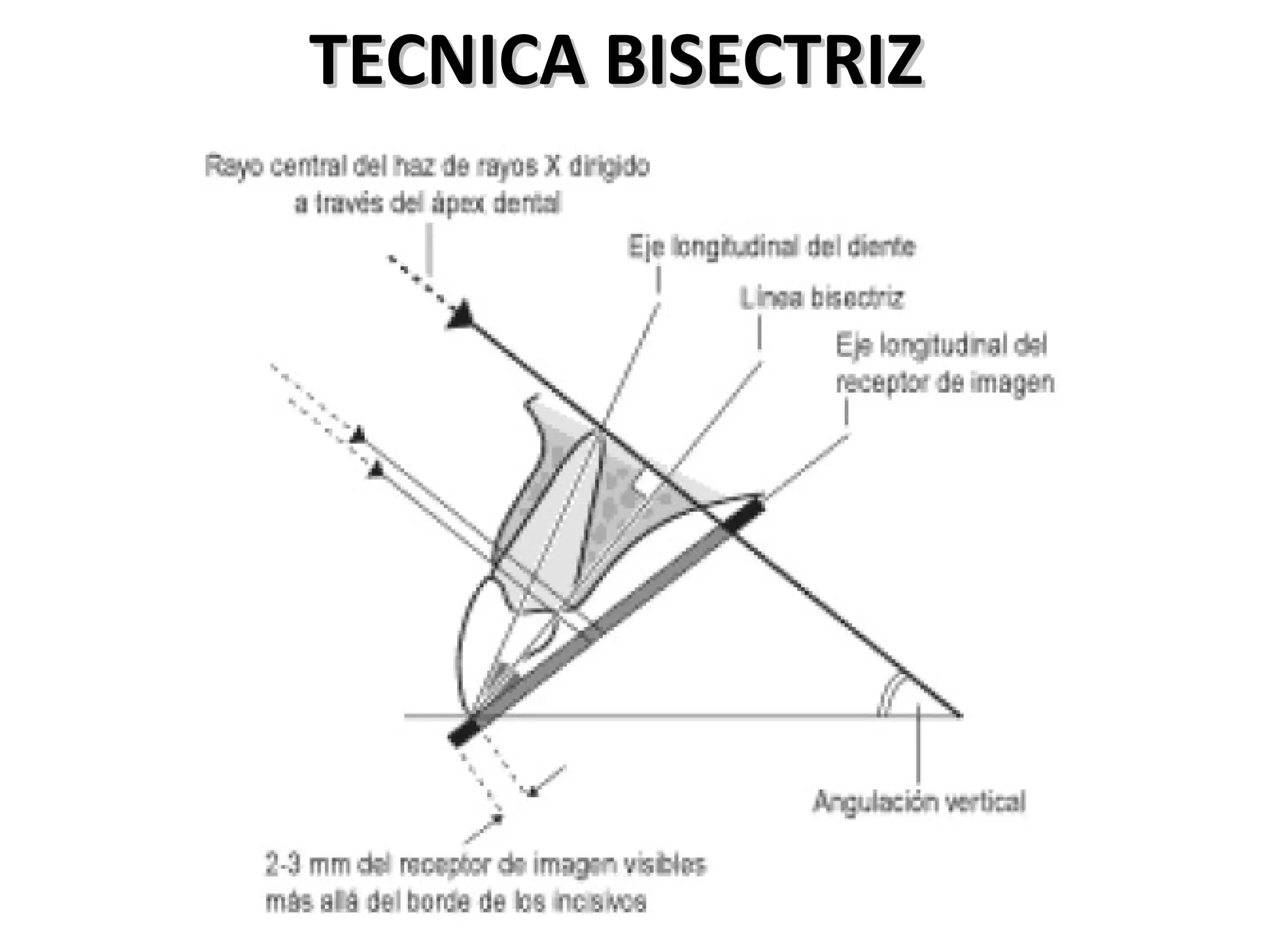 Tecnica de la bisectriz | PPT