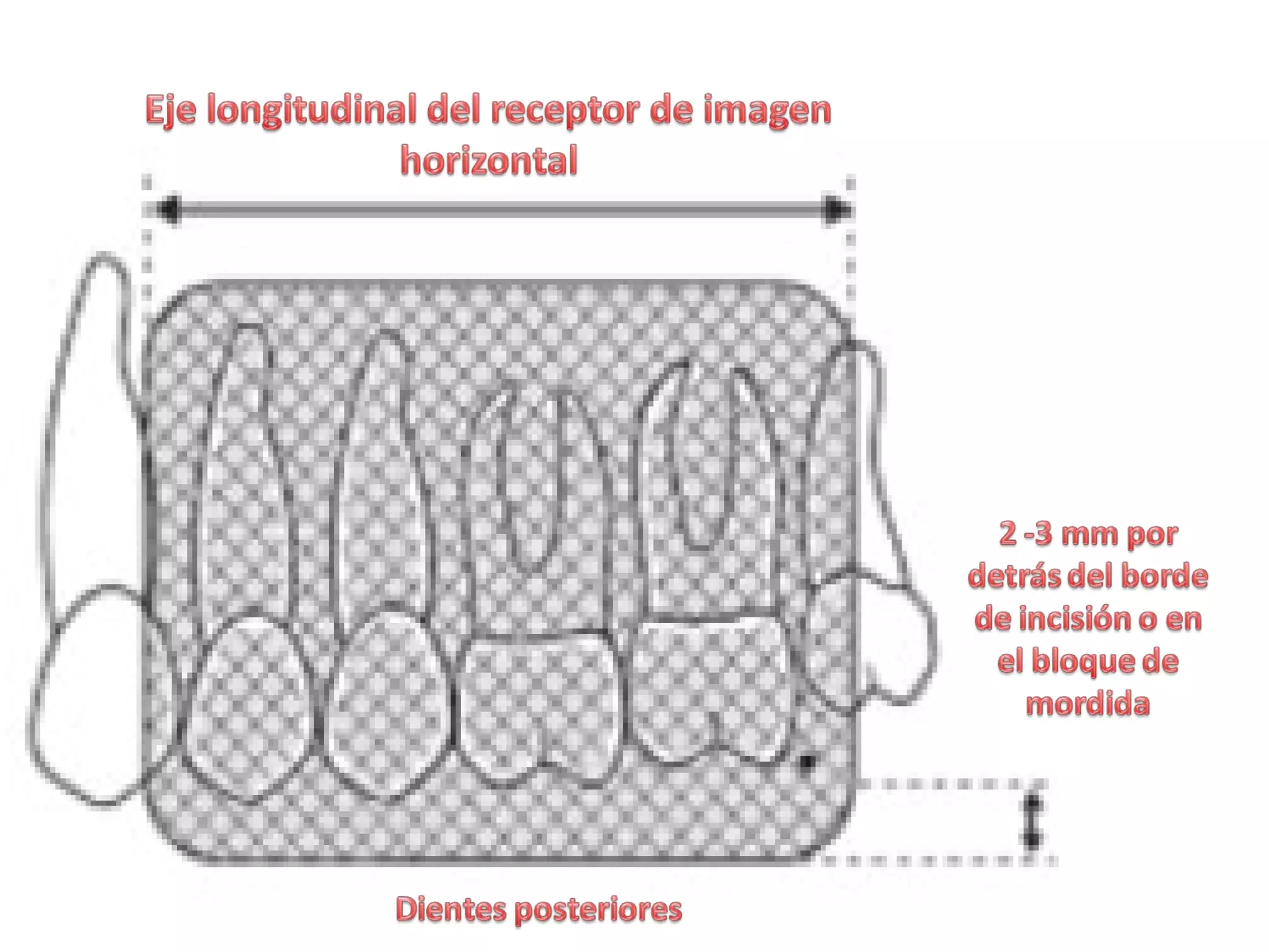 Tecnica de la bisectriz | PPT