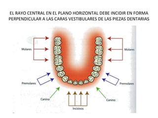 Tecnica de la bisectriz | PPT
