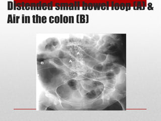 RADIOLOGI - ABDOMEN | PPT