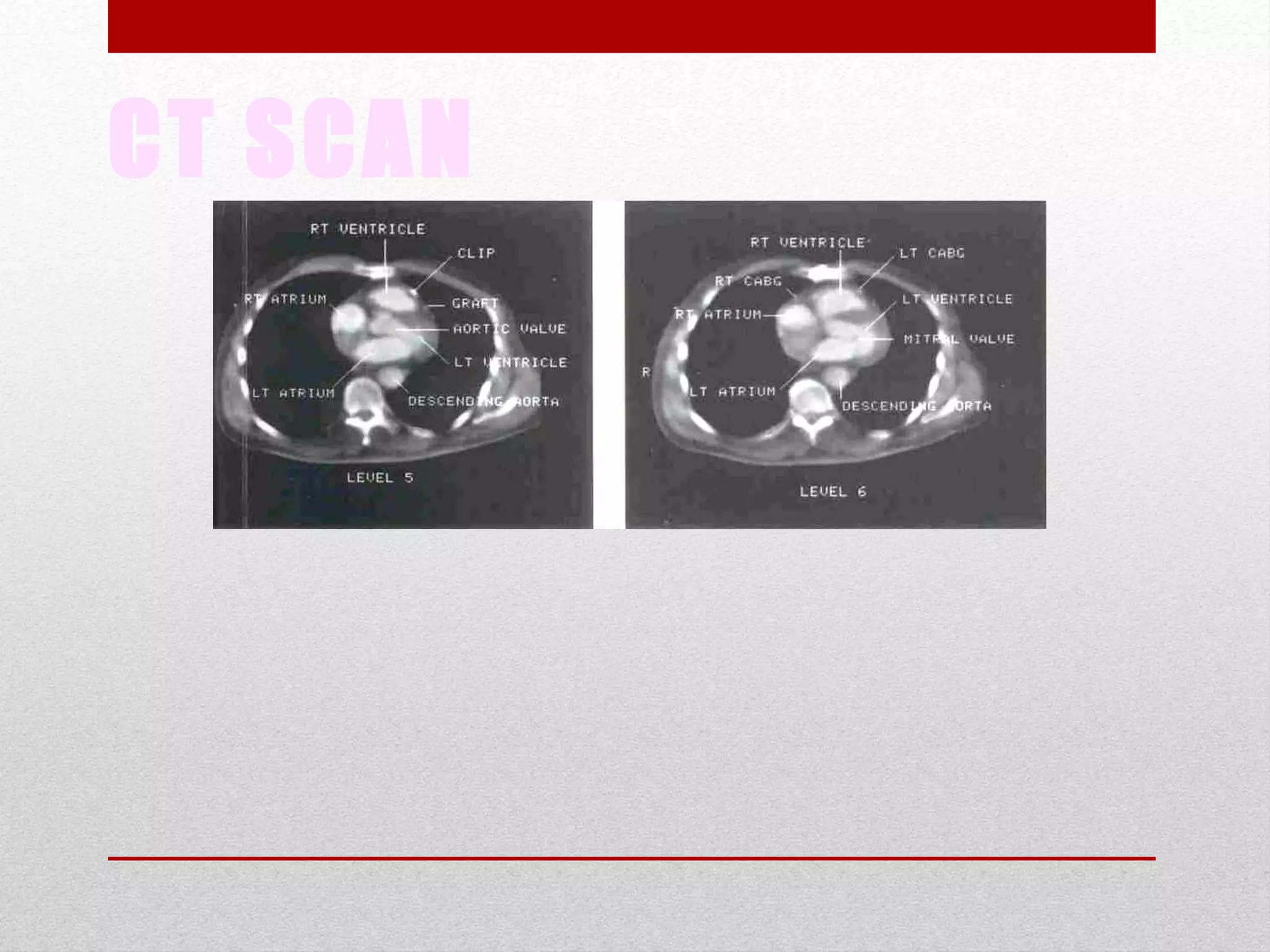 RADIOLOGI - SISTEM KARDIOVASKULAR | PPT
