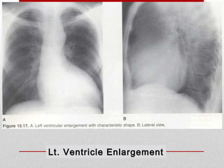 RADIOLOGI - SISTEM KARDIOVASKULAR | PPT