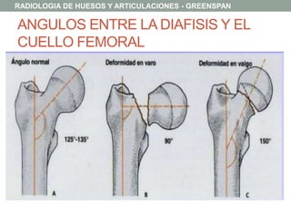 Radiologia de miembro inferior | PPTX