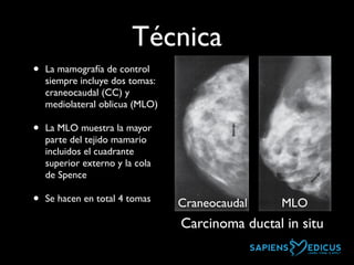 Radiologia de mama | PPT