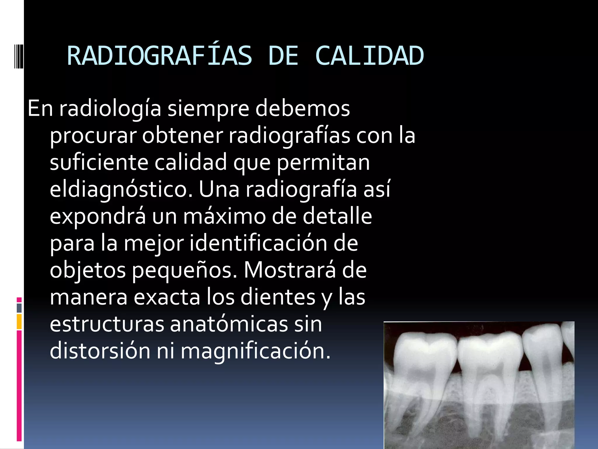 RADIOGRAFÍA DENTAL CORRECTA | PPTX | Dental Health | Diseases and ...