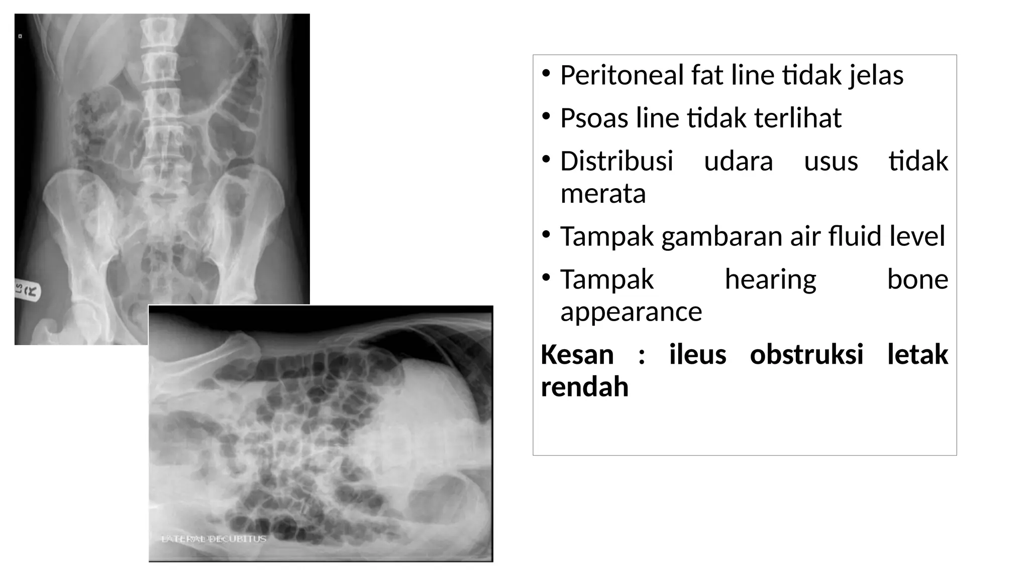 Gambaran dan Ekspertise Radiologi Abdomen.pptx