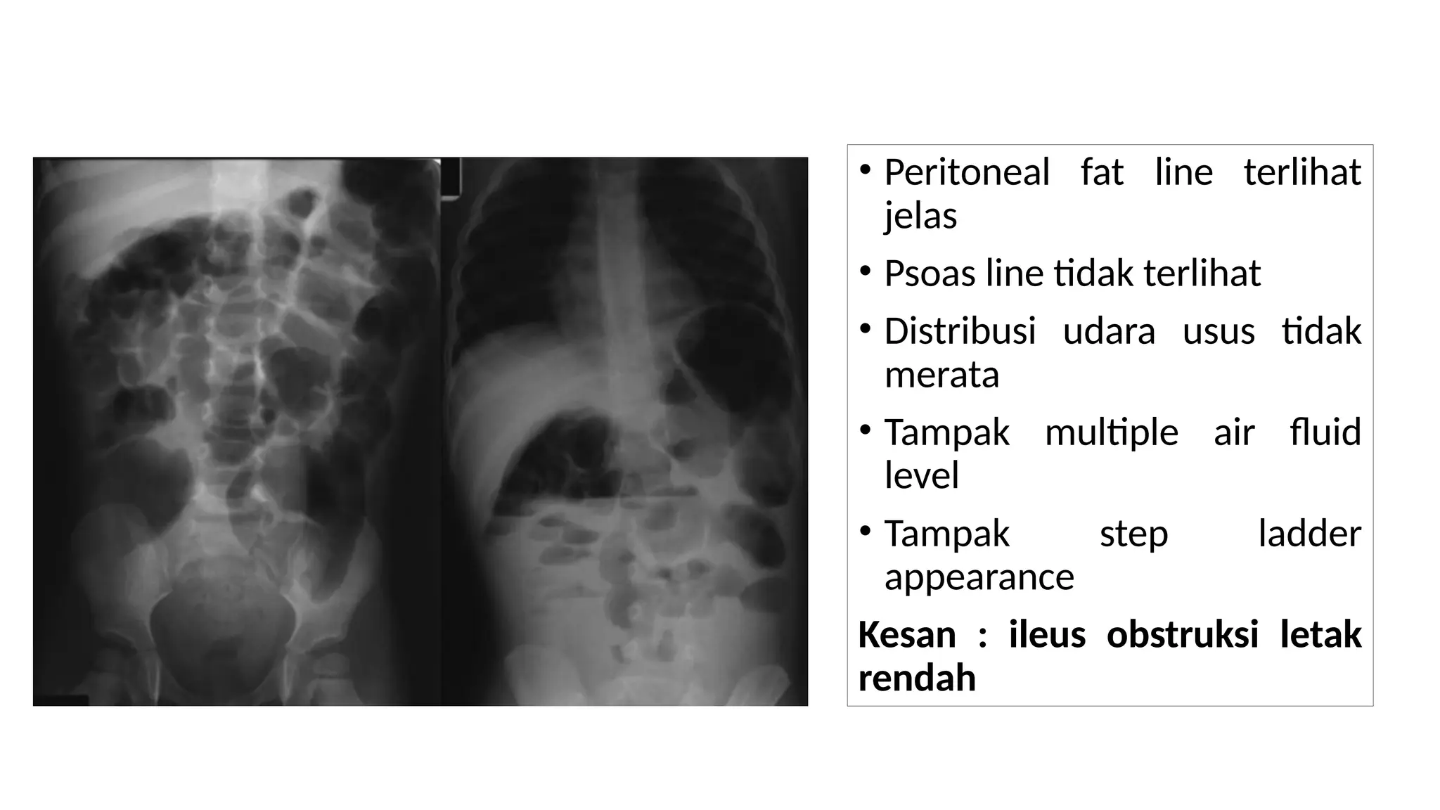 Gambaran dan Ekspertise Radiologi Abdomen.pptx