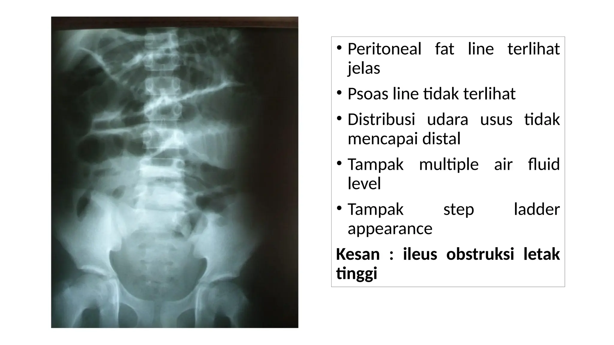 Gambaran dan Ekspertise Radiologi Abdomen.pptx
