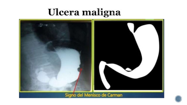 Radiologia de esofago y estomago