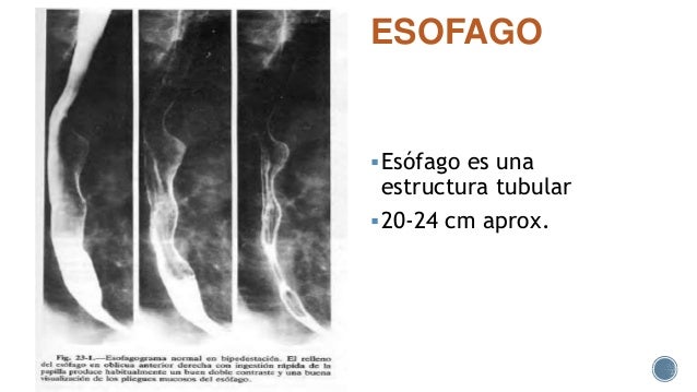 Radiologia de esofago y estomago