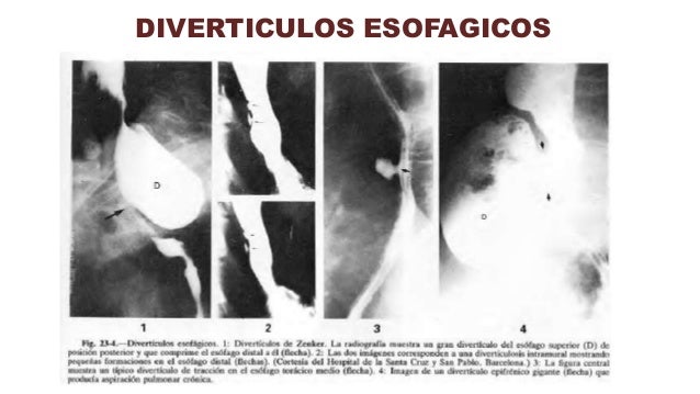 Radiologia de esofago y estomago