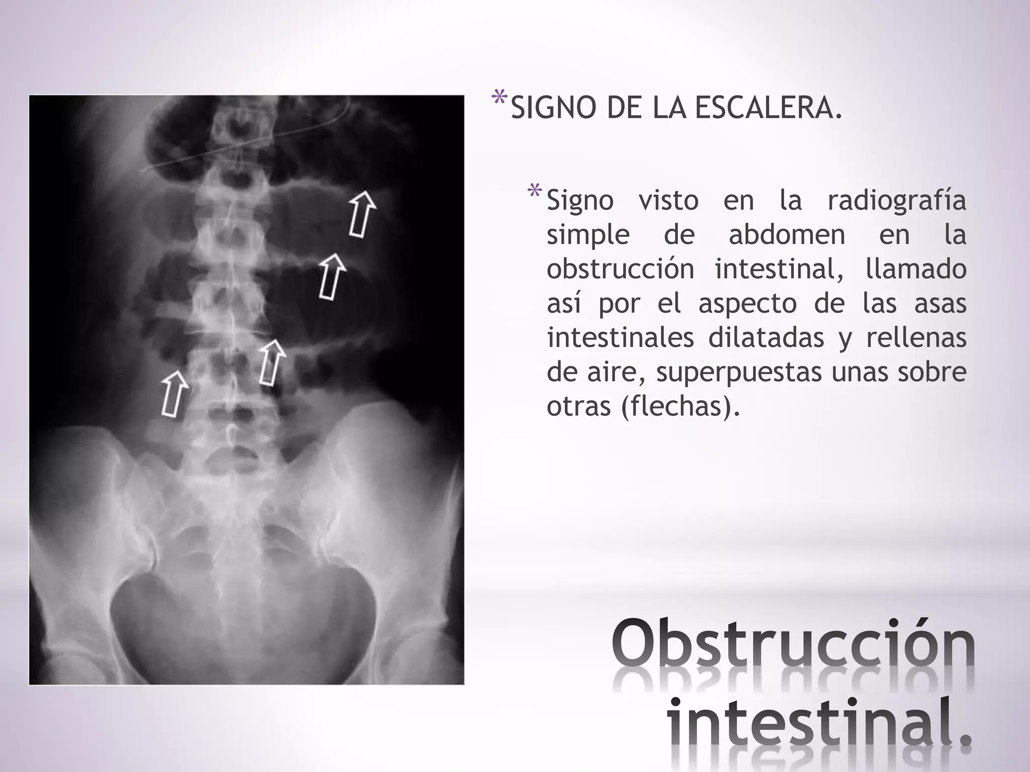 Radiologia del abdomen | PPTX