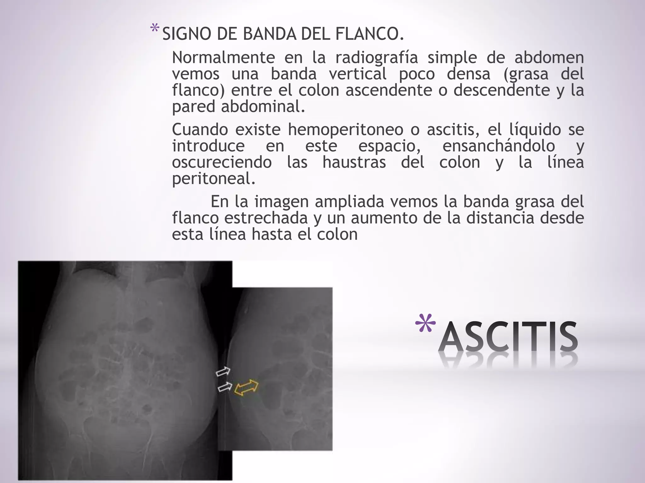 Radiologia del abdomen | PPTX